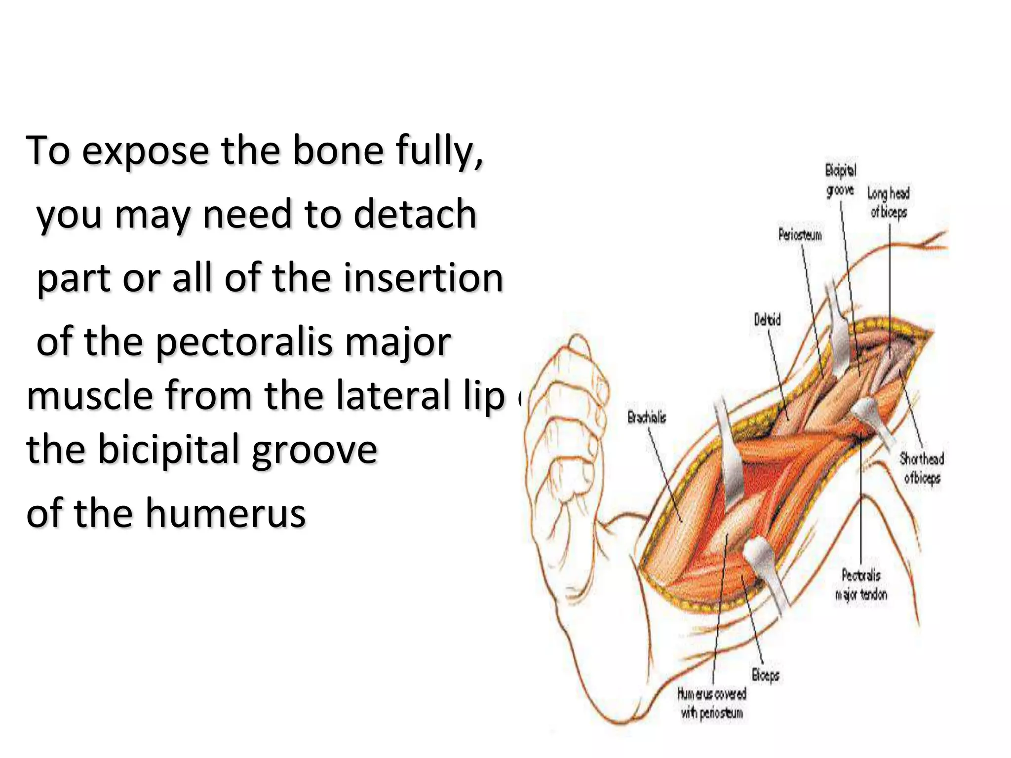 Approaches of humurus | PPT