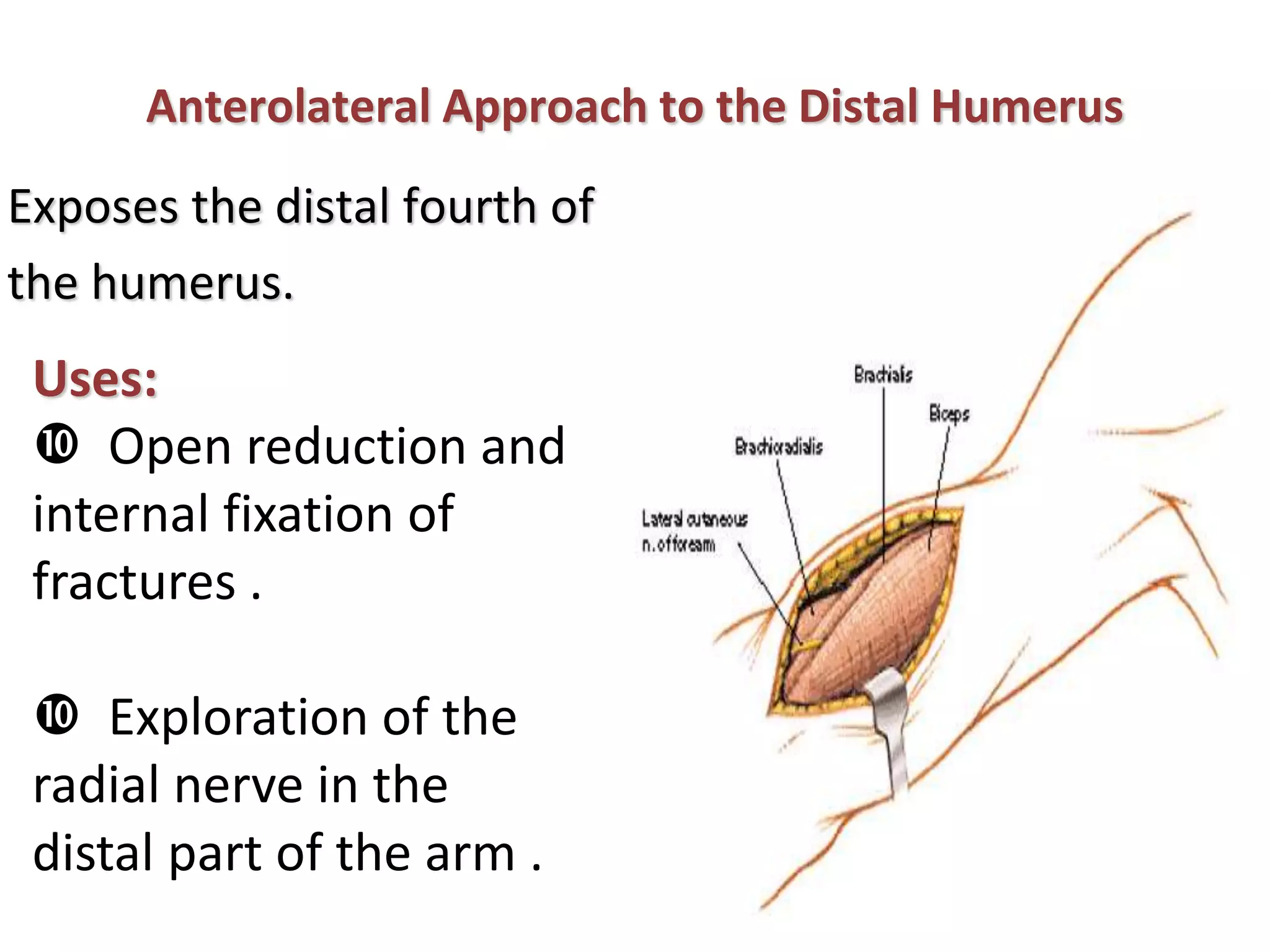 Approaches of humurus | PPT