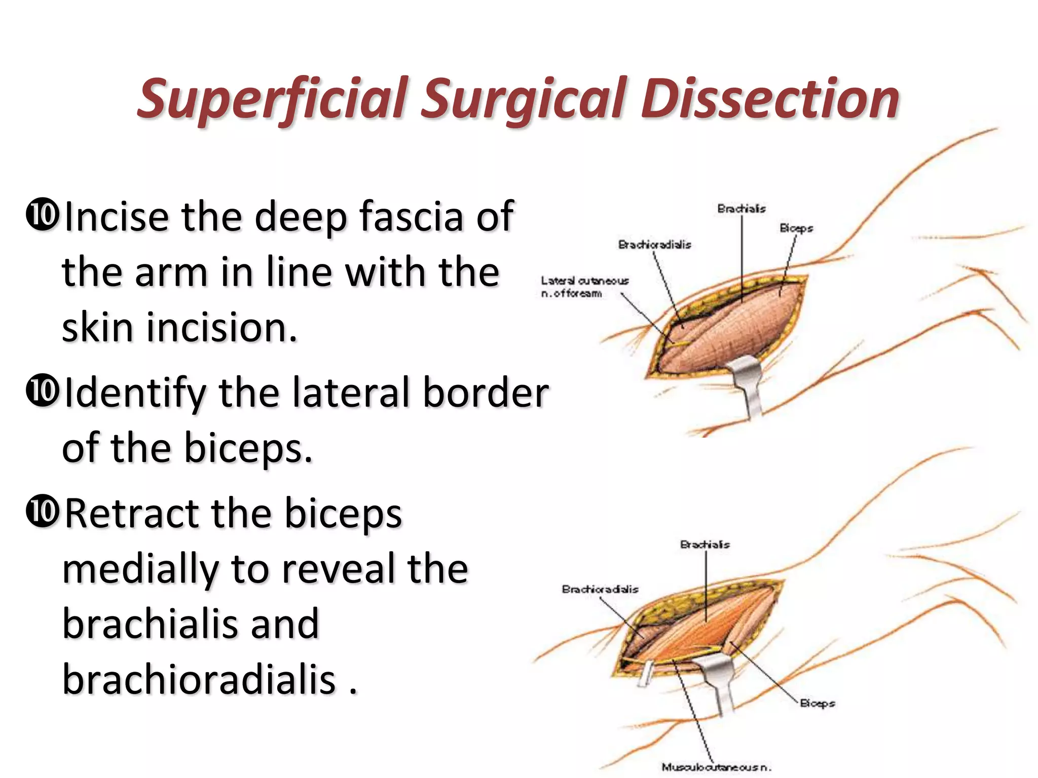 Approaches of humurus | PPT