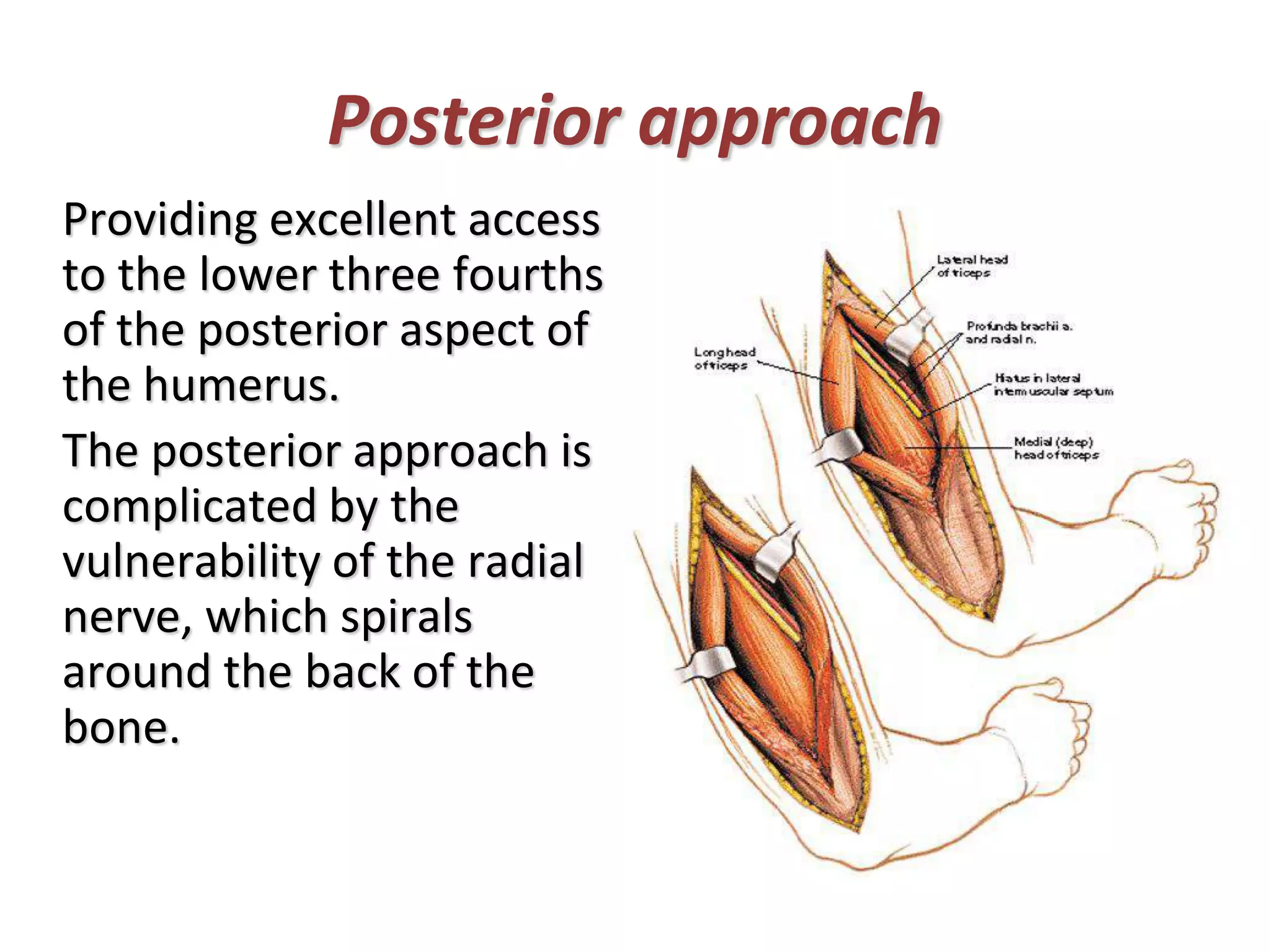 Approaches of humurus | PPT