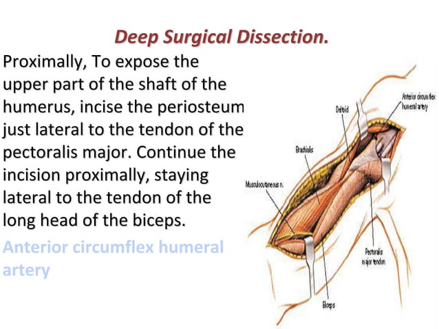 Approaches of humurus | PPT