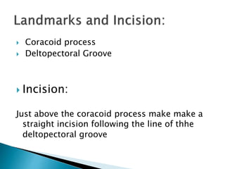 Approaches of shoulder | PPTX