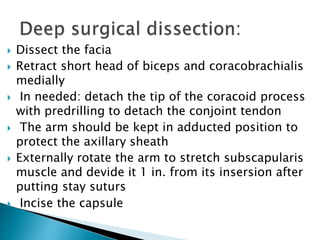 Approaches of shoulder | PPTX