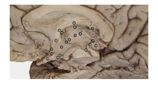 approaches to 3rd ventricle | PPTX