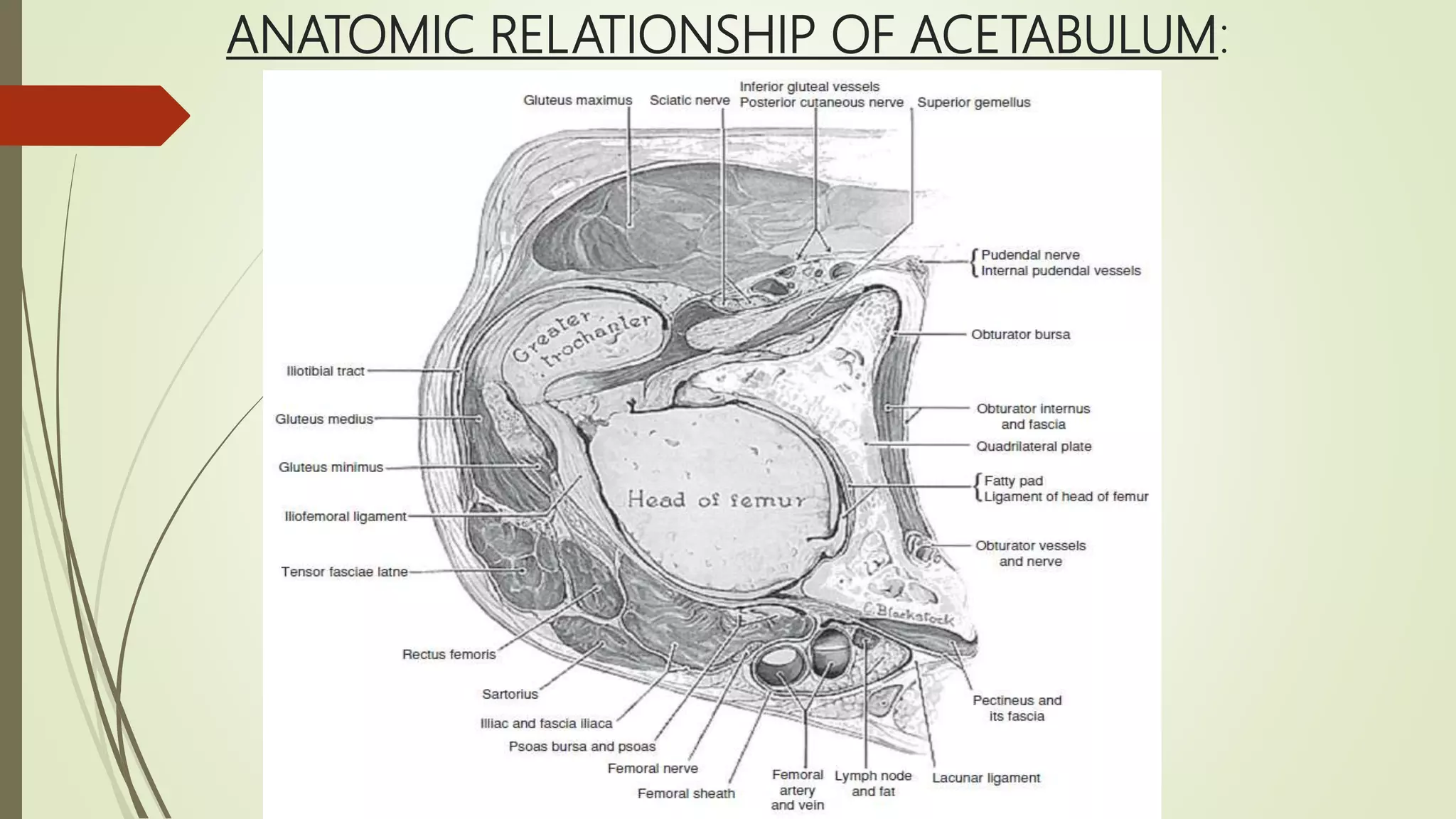 Approaches to Acetabulum- Dr Sharan | PPTX