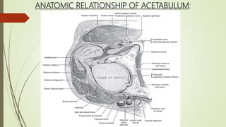 Approaches to Acetabulum- Dr Sharan | PPTX