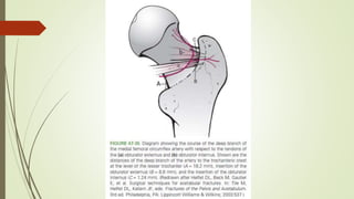 Approaches to Acetabulum- Dr Sharan | PPTX | Death, Injury, or Military ...