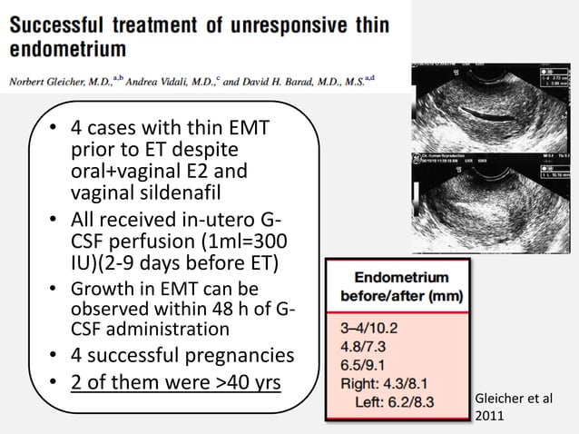 Approaches to a Thin Resistant Endometrium Prior to Embryo Transfer.ppt