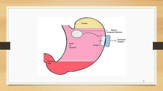 Approaches to extend gastro intestine transit | PPTX