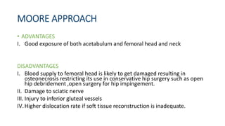 Approaches to hip joint | PPTX