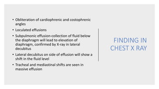 Approaches to pleural effusion | PPTX