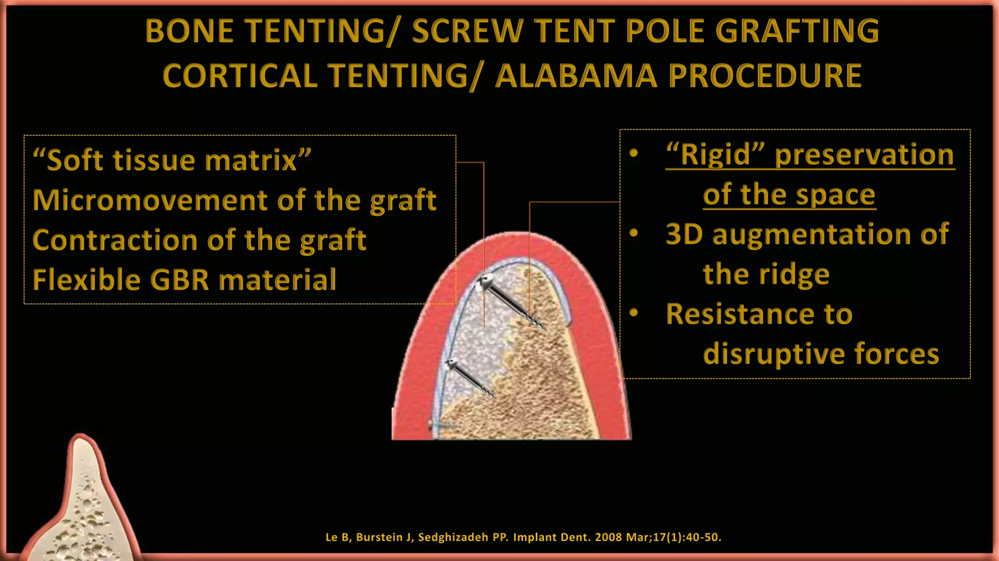 Approaches to ridge augmentation | PPTX