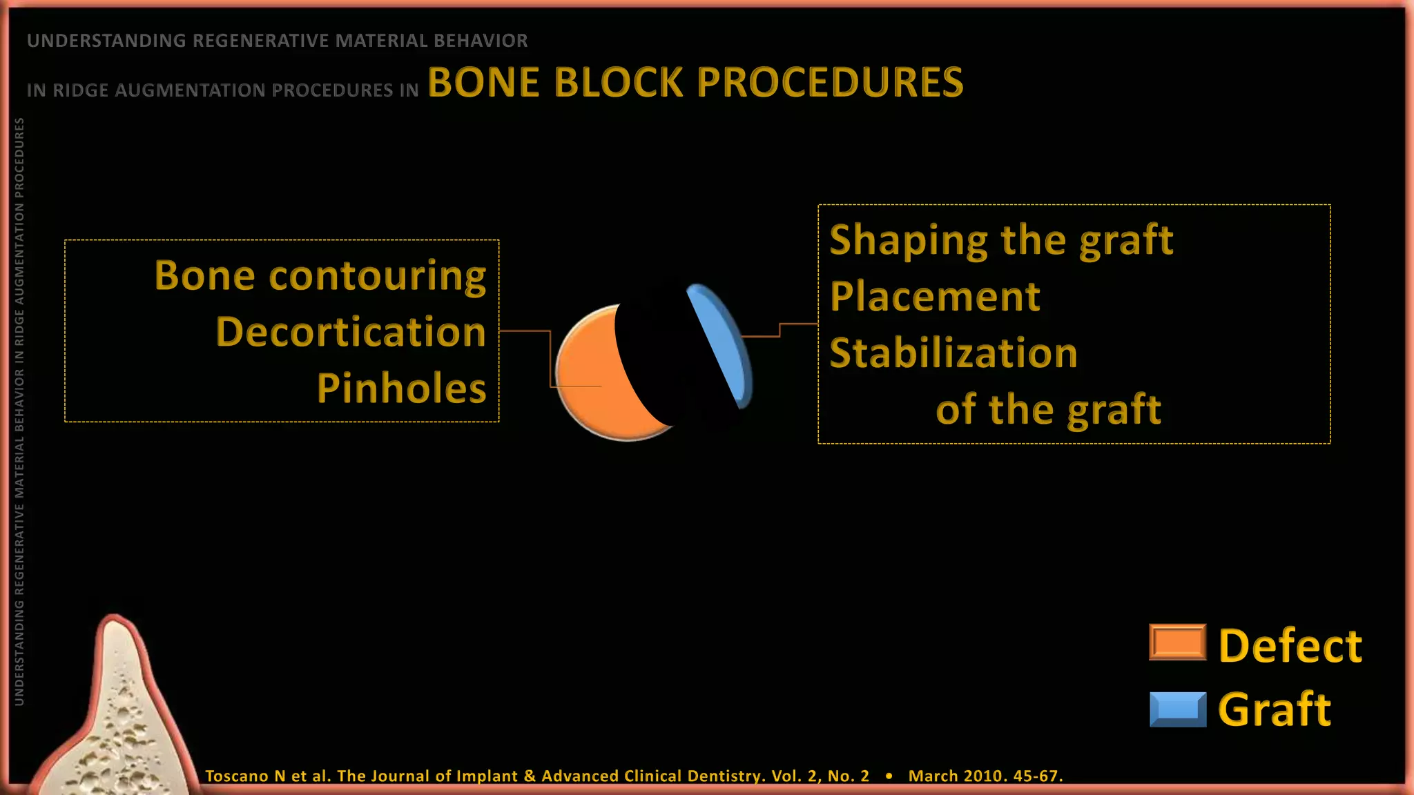 Approaches to ridge augmentation | PPTX