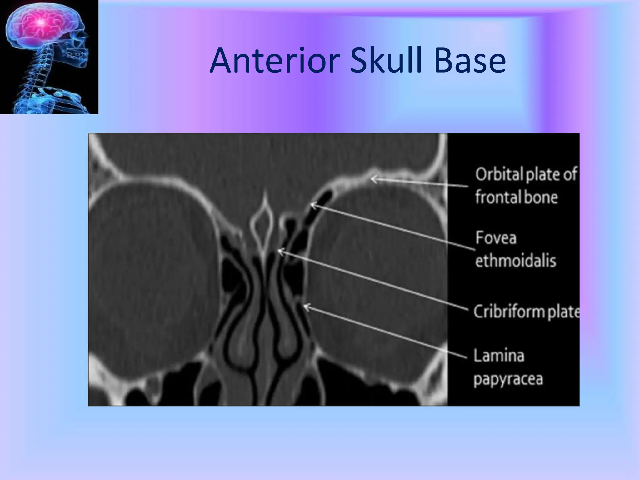 APPROACHES TO SKULL BASE AND APPLIED ASPECT.pptx