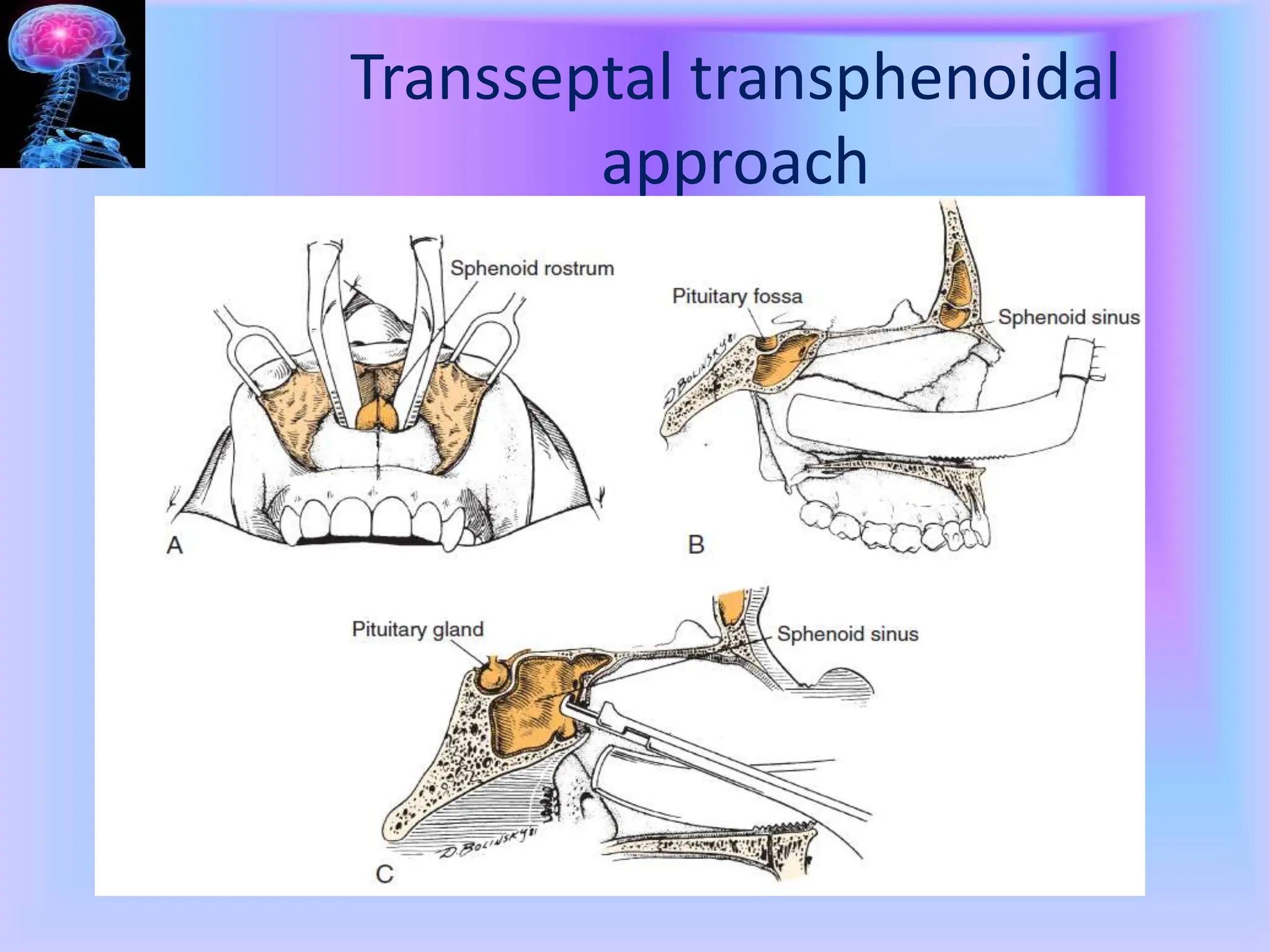 APPROACHES TO SKULL BASE AND APPLIED ASPECT.pptx