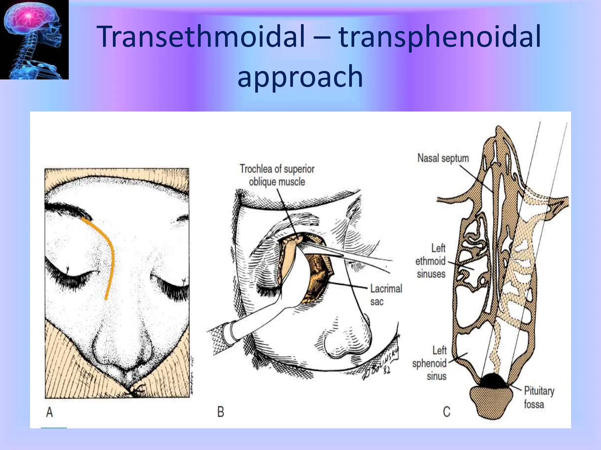APPROACHES TO SKULL BASE AND APPLIED ASPECT.pptx