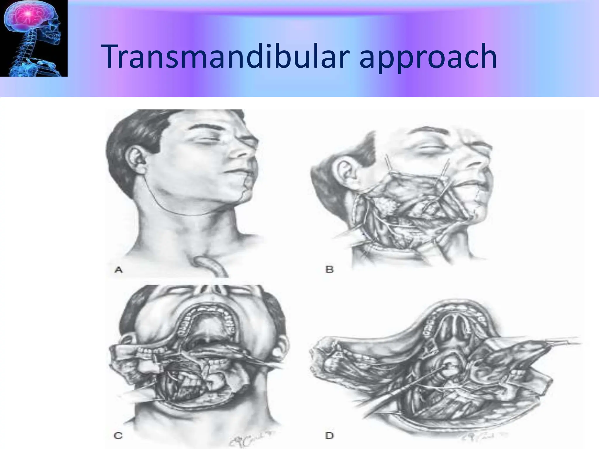 APPROACHES TO SKULL BASE AND APPLIED ASPECT.pptx
