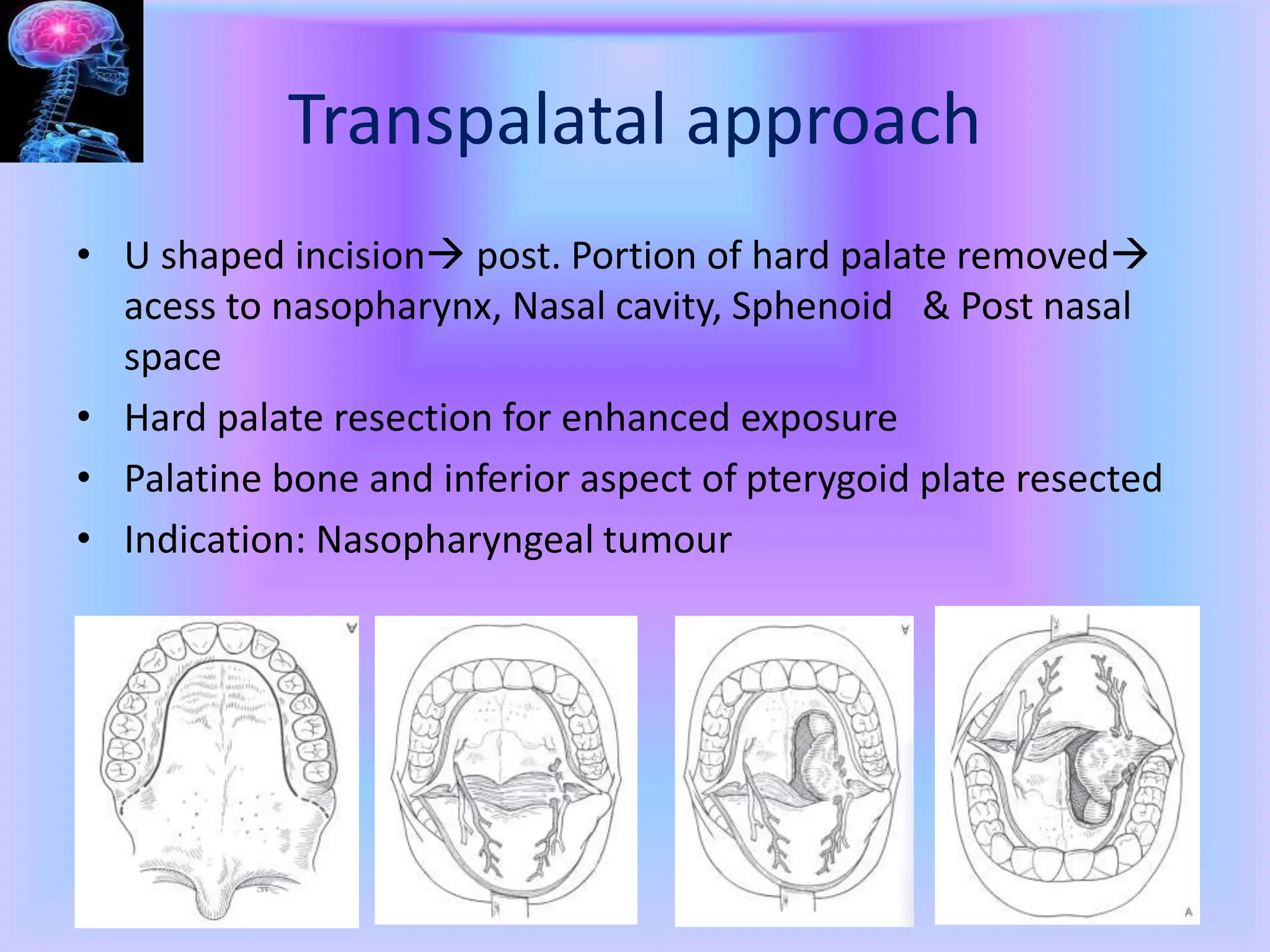 APPROACHES TO SKULL BASE AND APPLIED ASPECT.pptx