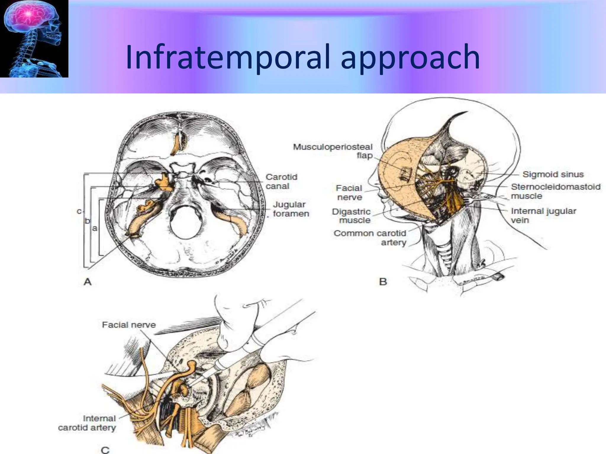 APPROACHES TO SKULL BASE AND APPLIED ASPECT.pptx