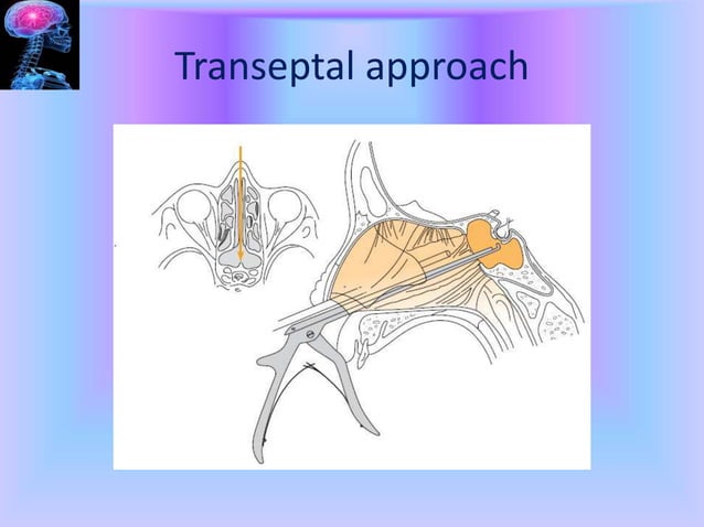 APPROACHES TO SKULL BASE AND APPLIED ASPECT.pptx