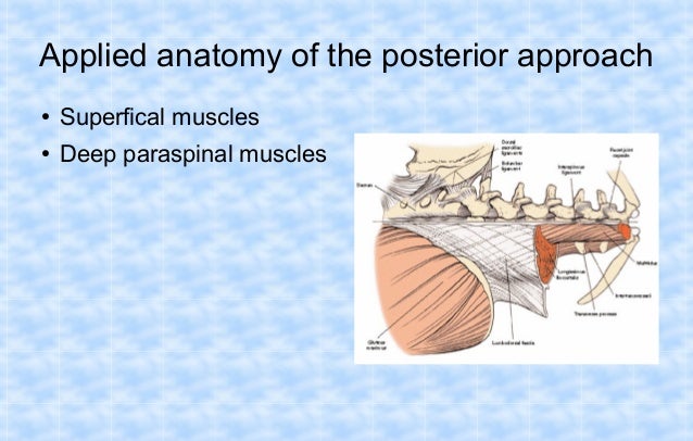 Approaches to spine