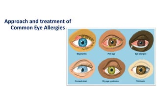 approachforcommoneyeallergy 1.pptx