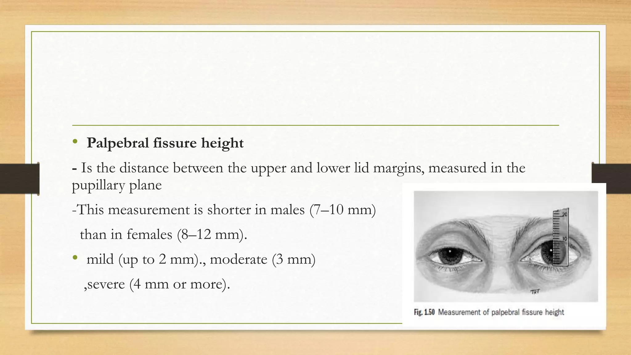 Approach for ptosis | PPTX