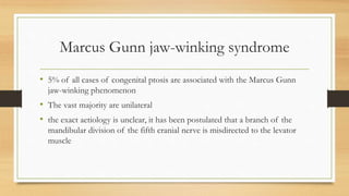 Approach for ptosis | PPTX