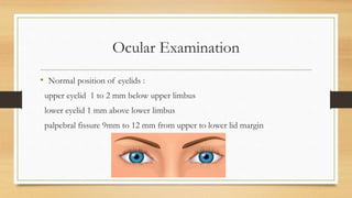 Approach for ptosis | PPTX