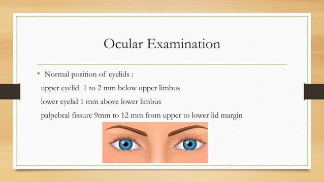 Approach for ptosis | PPTX | Eye and Vision Conditions | Diseases and ...