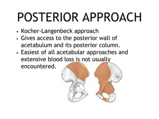 Surgical Approach to Hip and Acetabulum | PPTX