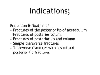 Surgical Approach to Hip and Acetabulum | PPTX