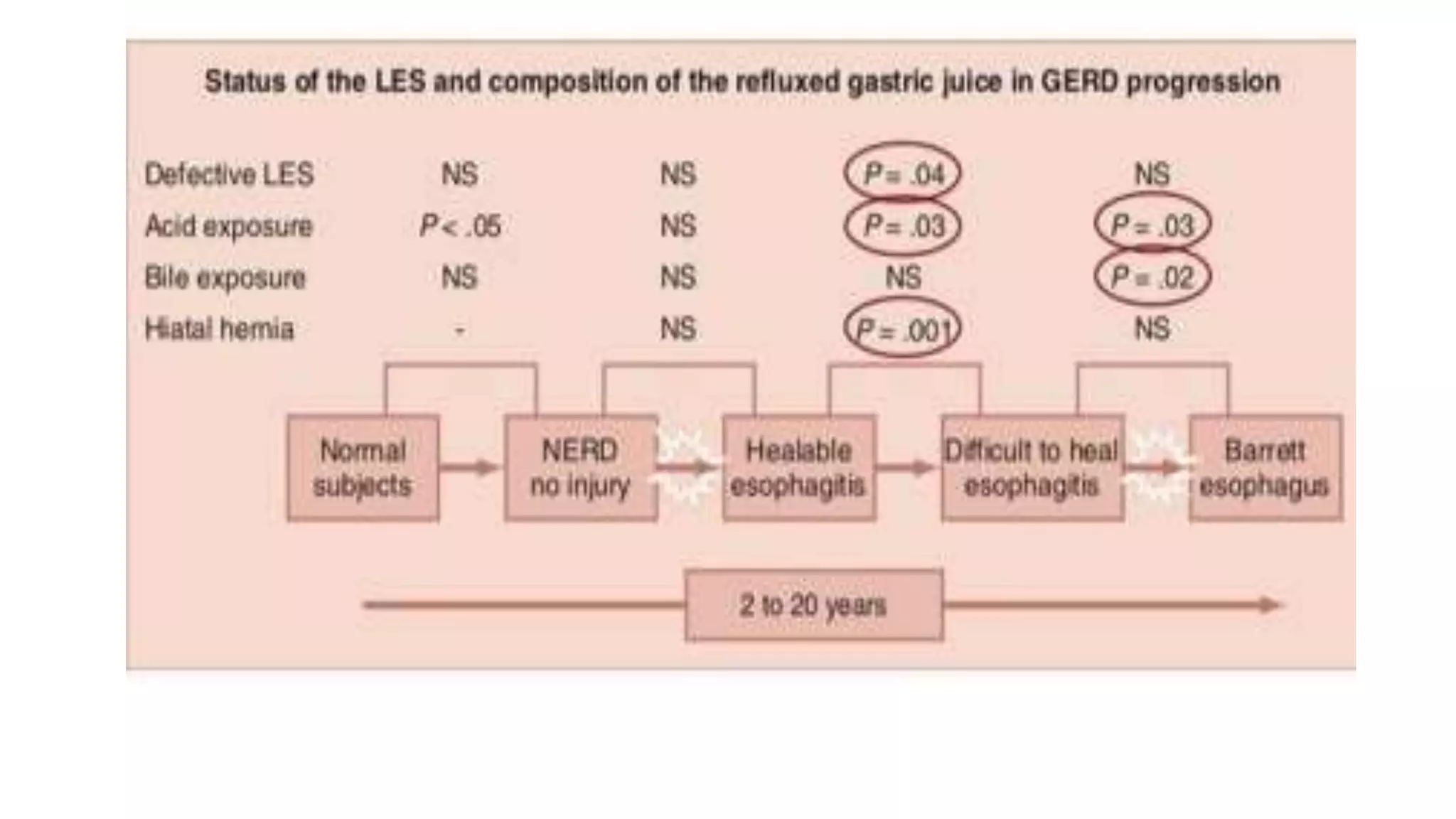 Approach, indications and surgical management of gerd 2 | PPTX