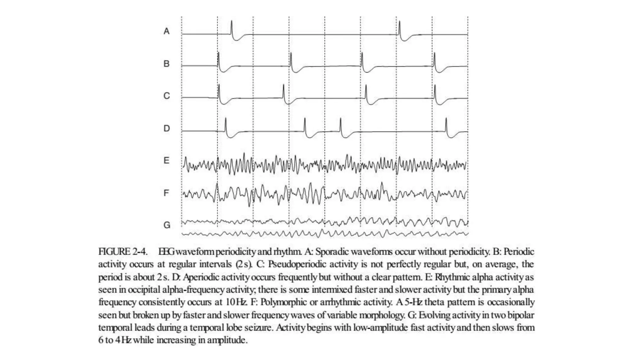 Approaching the eeg | PPTX
