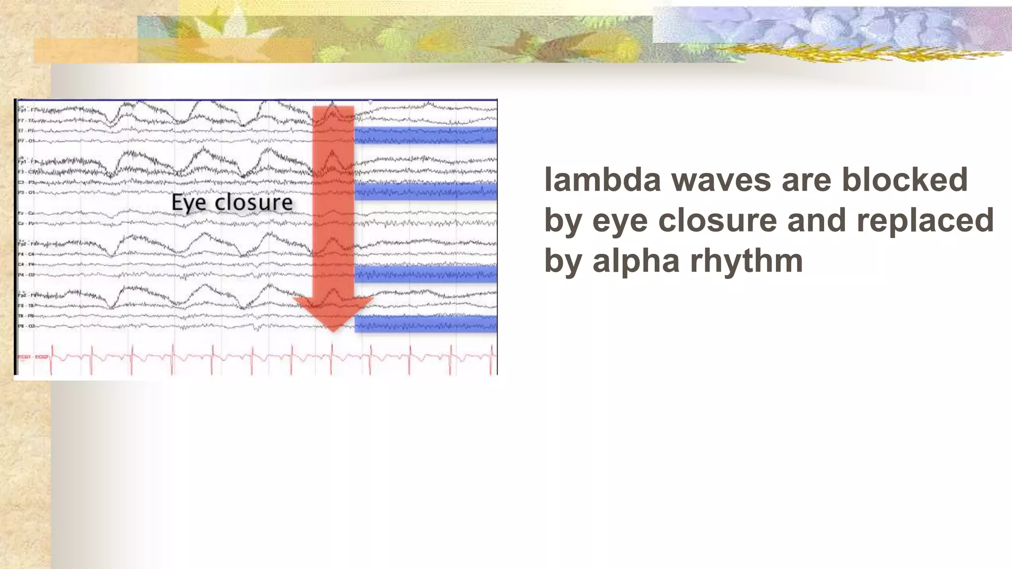 Approaching the eeg | PPTX