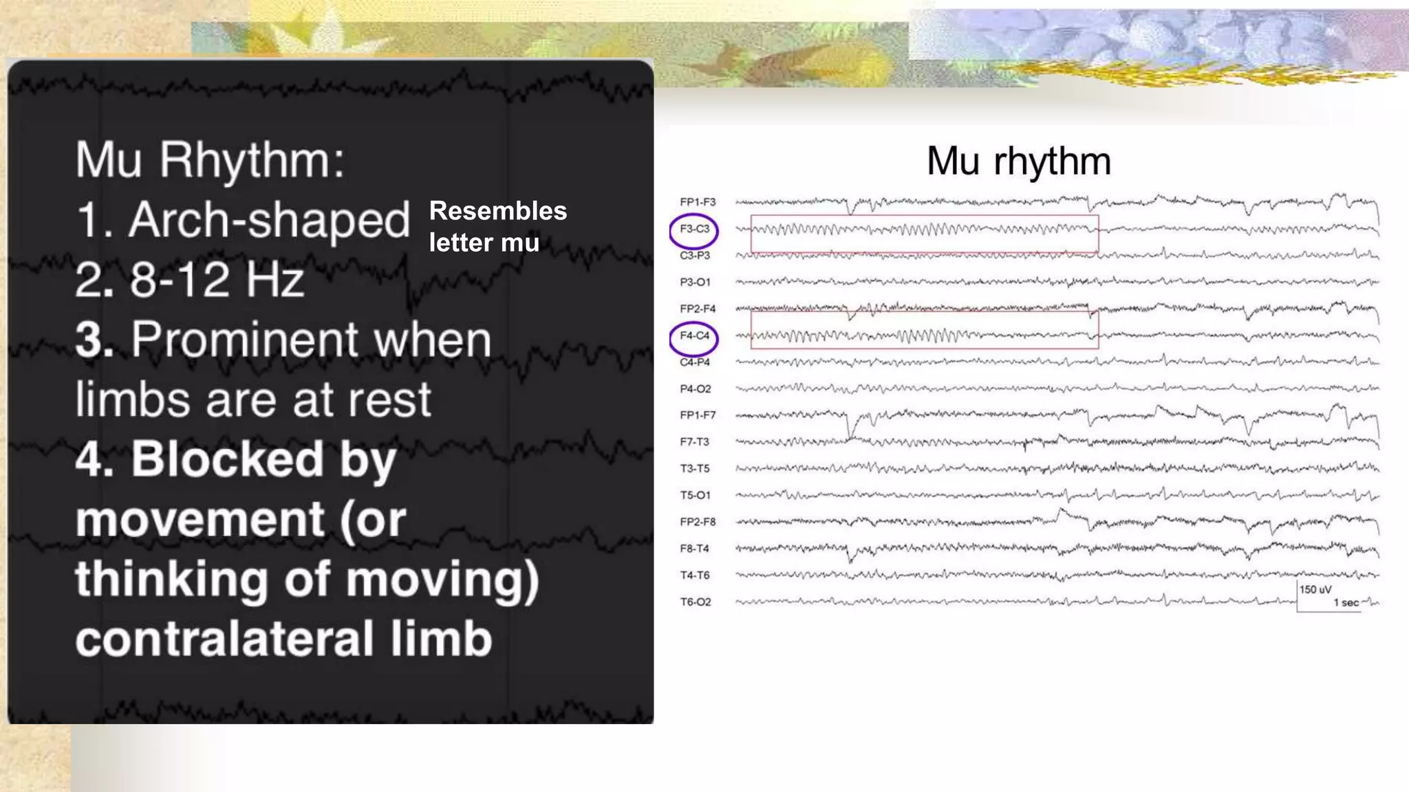 Approaching the eeg | PPTX