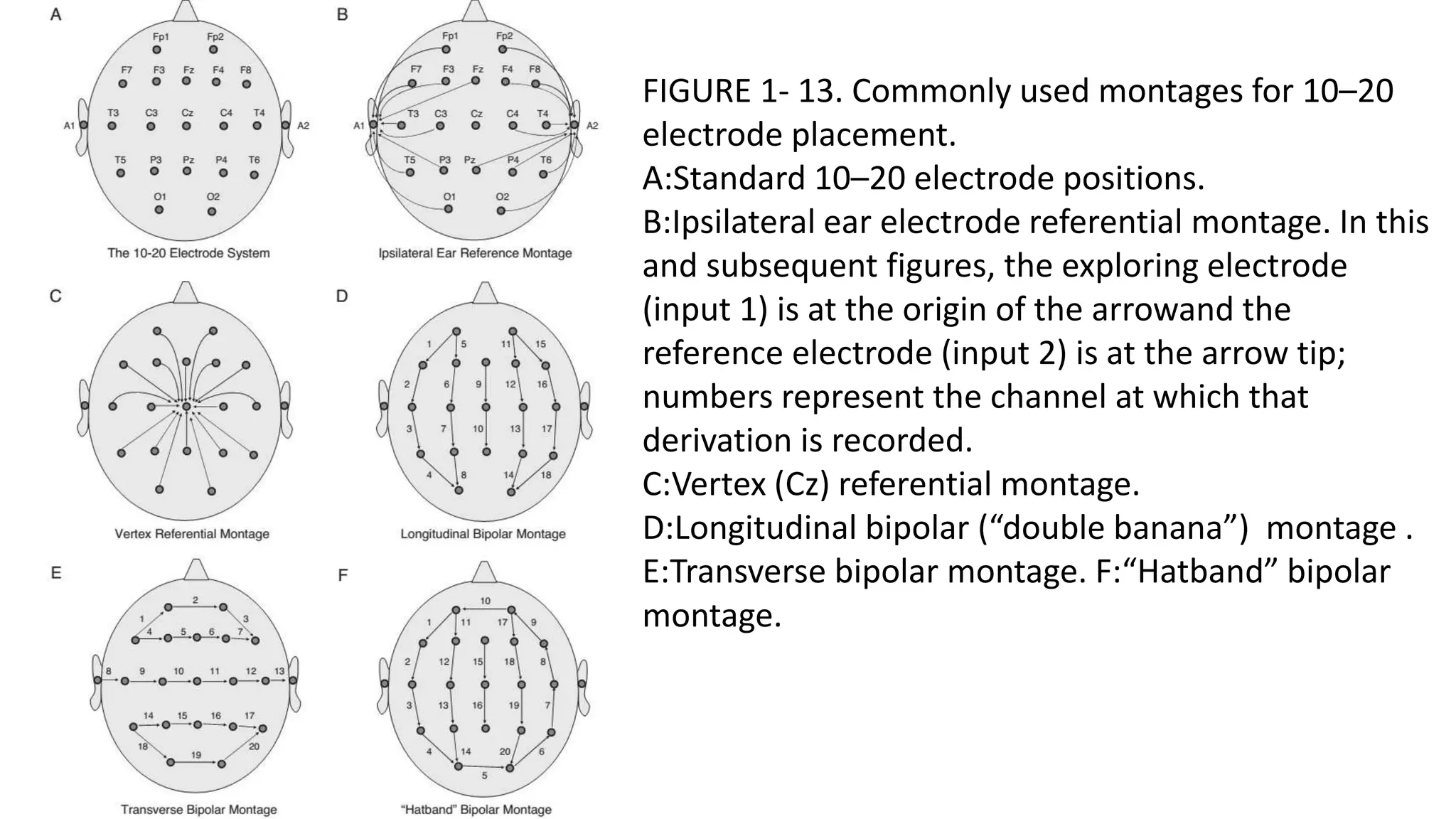 Approaching the eeg | PPTX