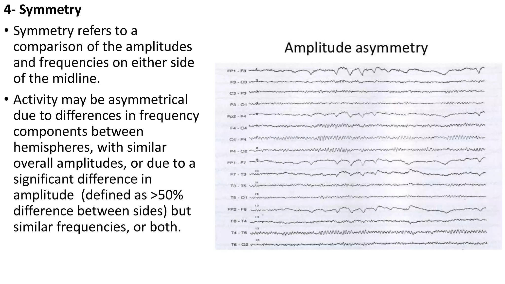 Approaching the eeg | PPTX
