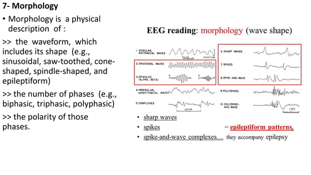 Approaching the eeg | PPTX | Brain and Nervous System Disorders ...
