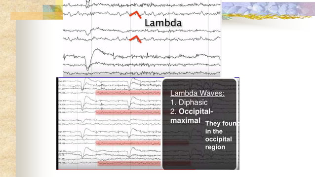 Approaching the eeg | PPTX | Brain and Nervous System Disorders ...