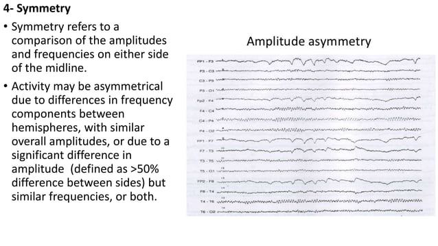 Approaching the eeg | PPTX | Brain and Nervous System Disorders ...