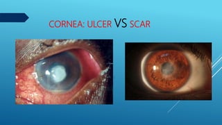 Approaching the Red eyes | PPT