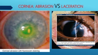 Approaching the Red eyes | PPT