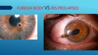 Approaching the Red eyes | PPT