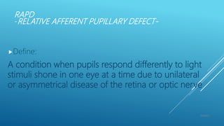 Approaching the Red eyes | PPT | Eye and Vision Conditions | Diseases ...