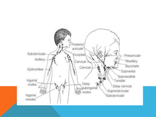 Approach in lymphadenopathy in children | PPTX