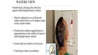 Approach of paranasal sinuses radiology .pptx