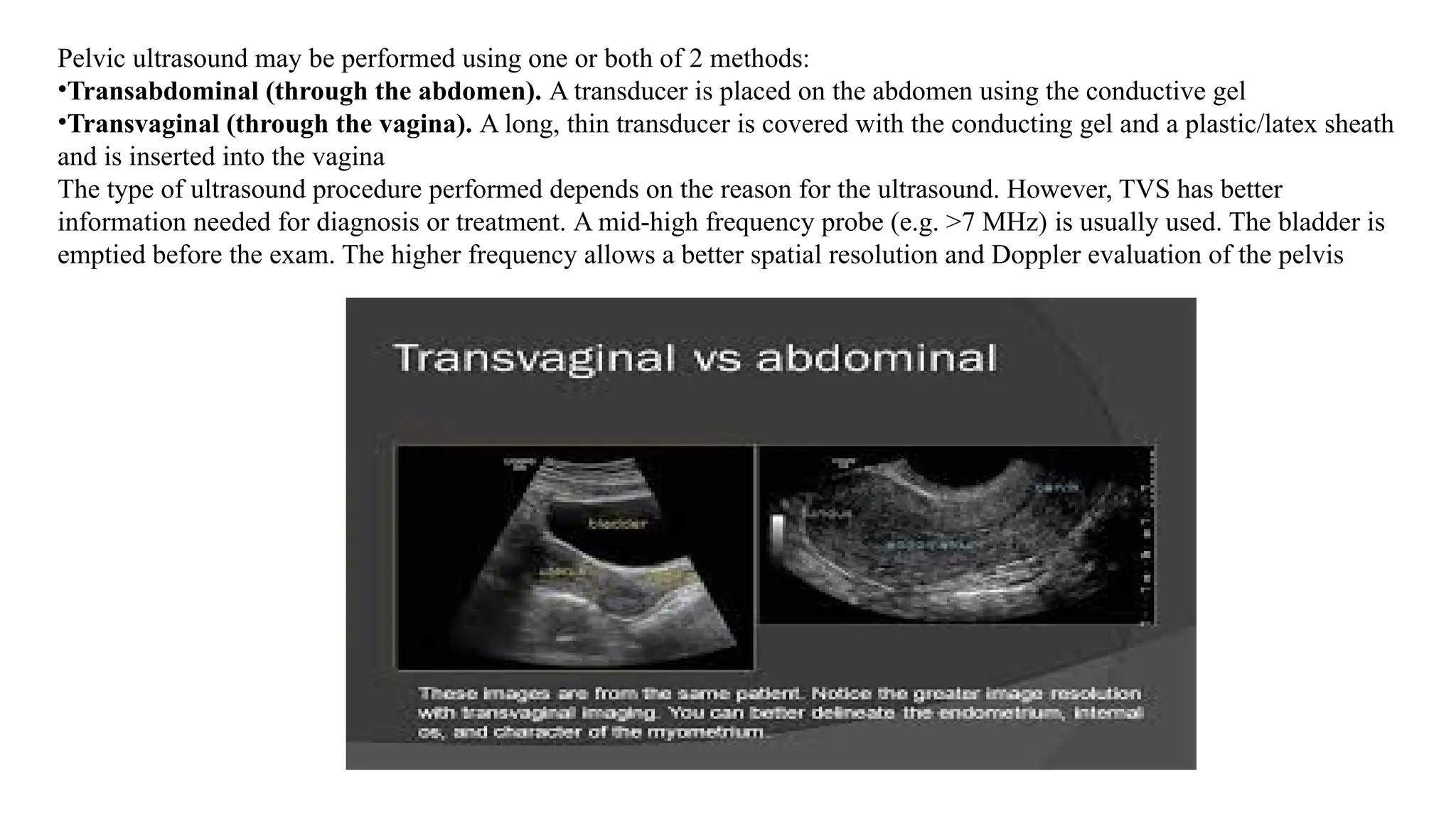 APPROACH ON ABDOMINAL PELVIC ULTRASOUND.pptx