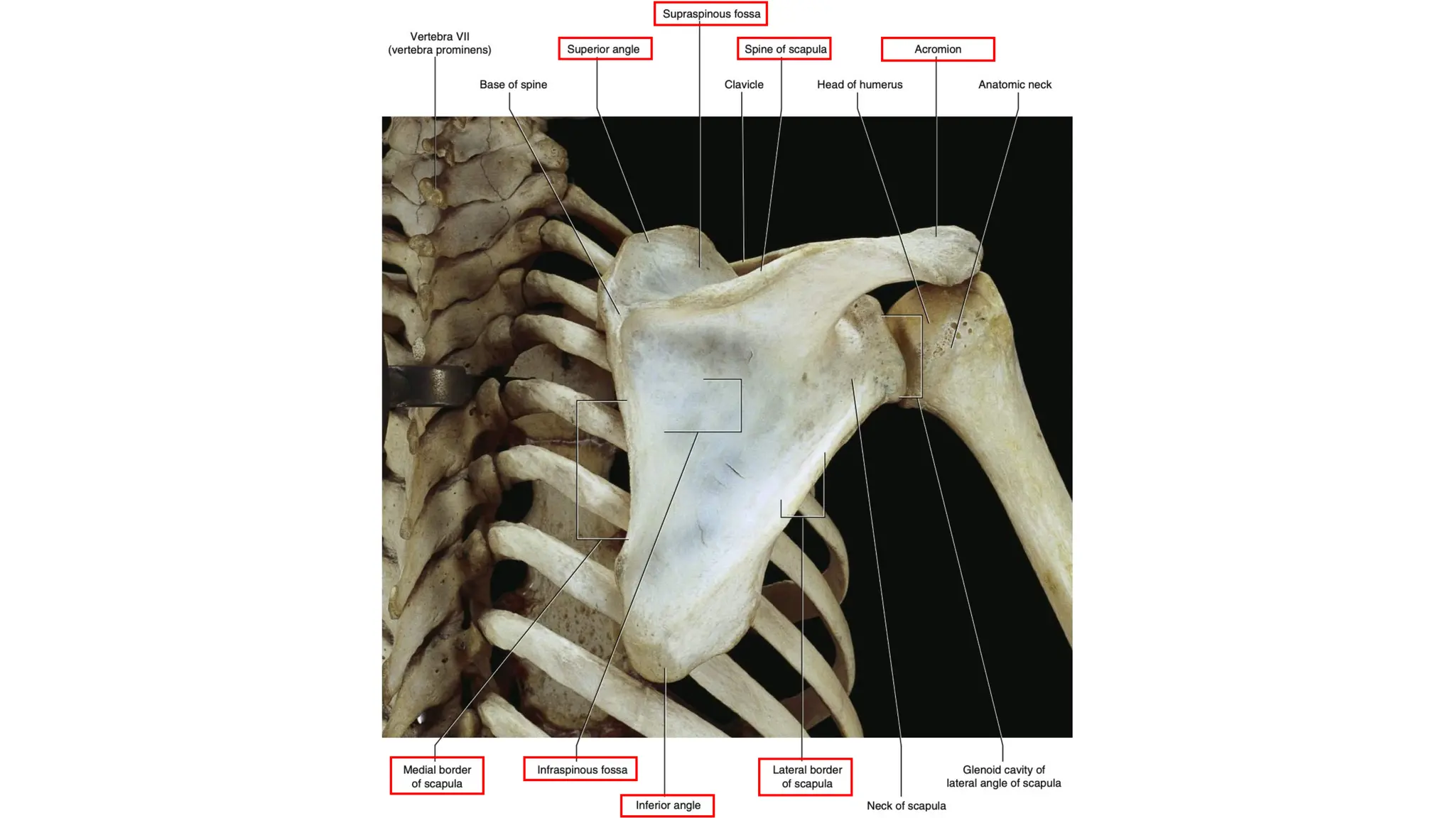Approach Scapula in Orthopedic Field.pptx