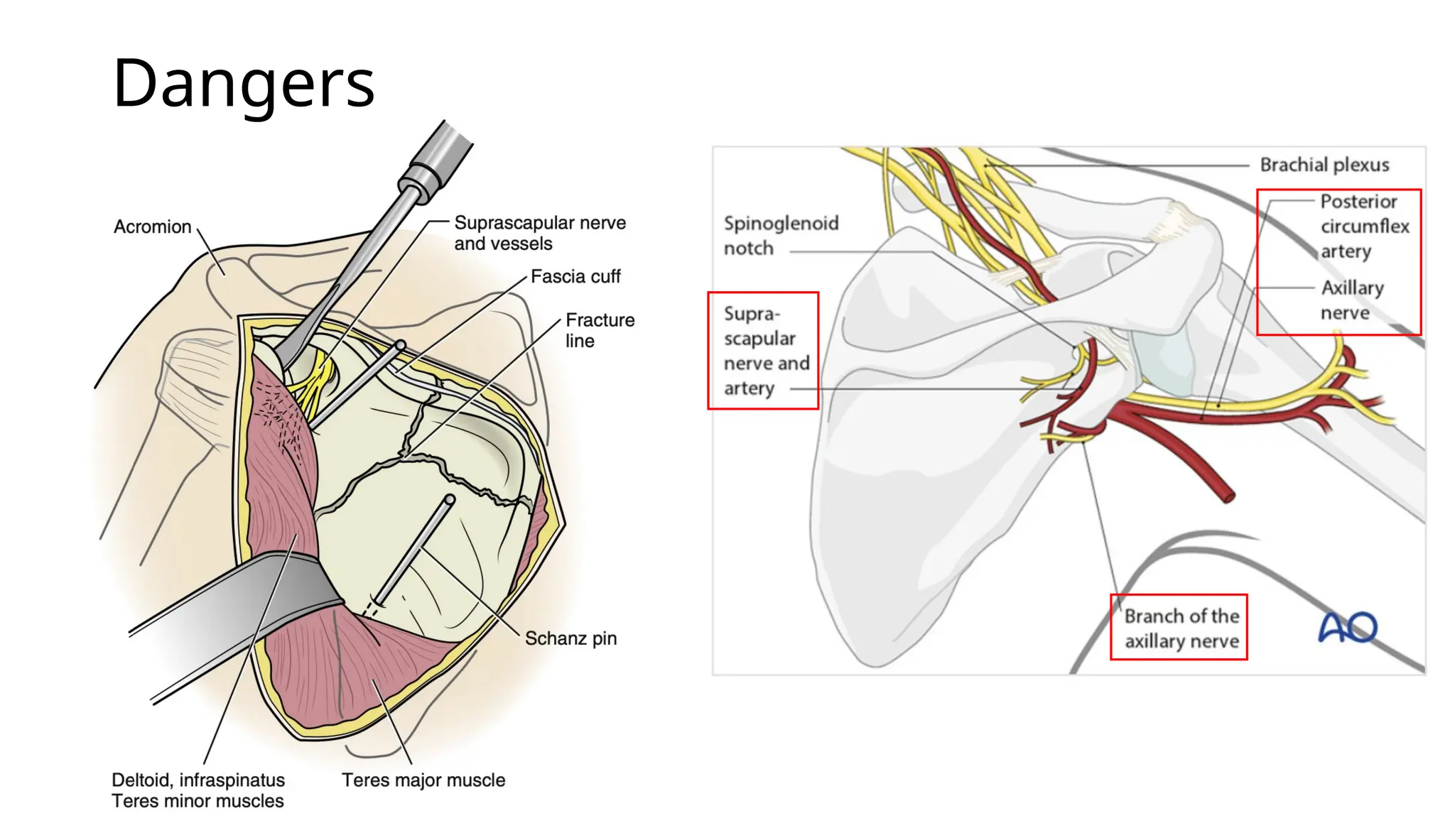 Approach Scapula in Orthopedic Field.pptx